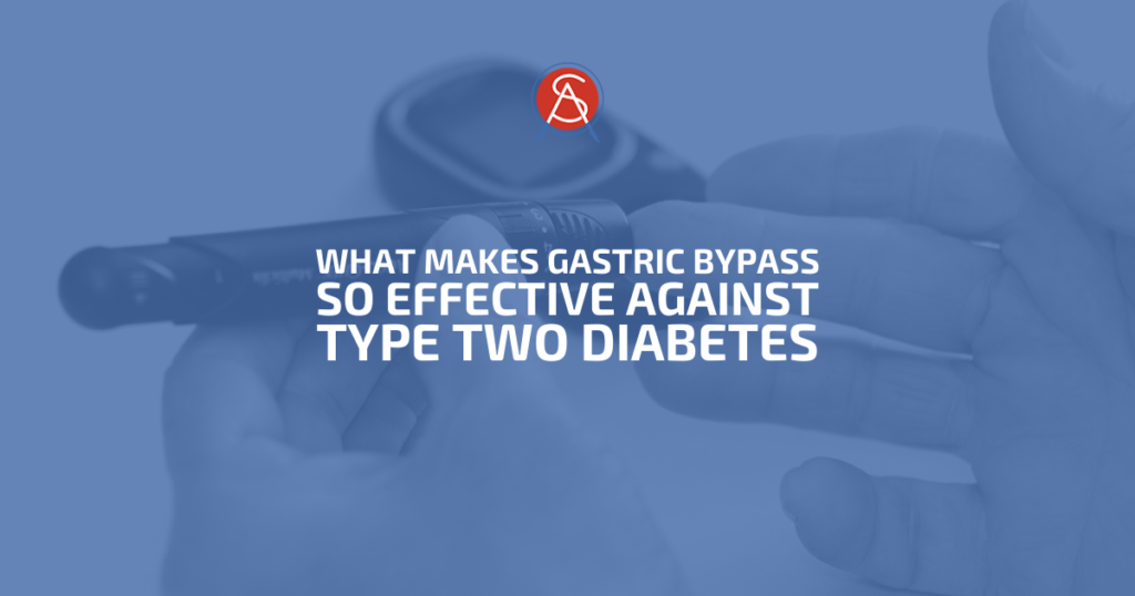 Why Gastric Bypass is so Effective for Type-2 Diabetes